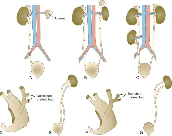 Surgical Implications of Variations | Anatomical Variations and ...