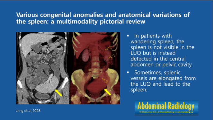 Variations in Visceral Anatomy | Anatomical Variations and Anomalies ...