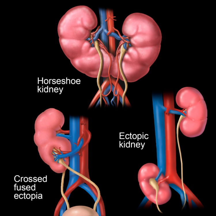 Variations in Visceral Anatomy | Anatomical Variations and Anomalies ...