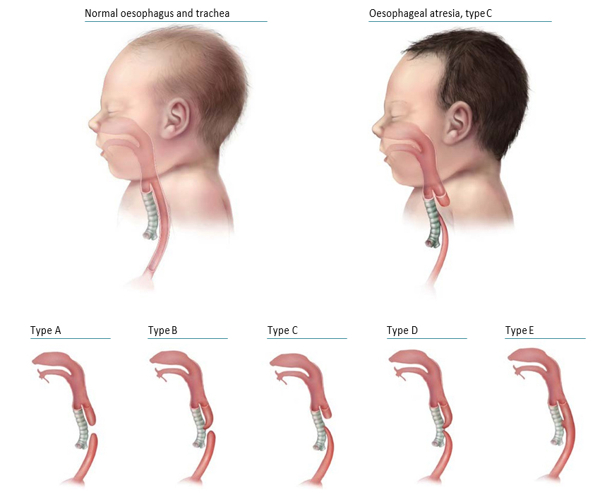 Development of Gastrointestinal System | Embryology and Development ...
