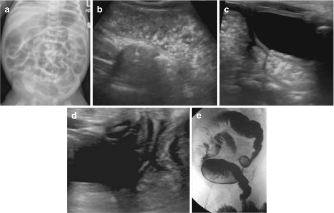 Pediatric Abdominal Imaging | Pediatric Radiology - OnCourse NEET-PG